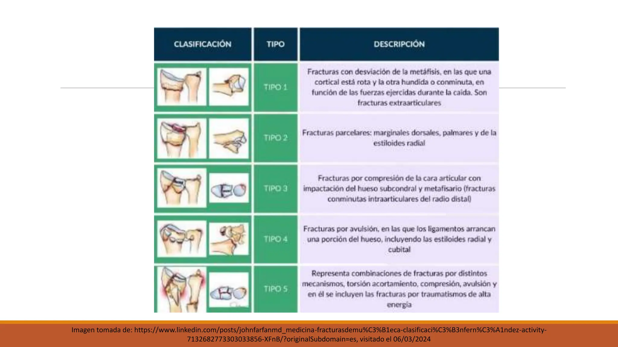 Clasificación Frykman y Fernández Fx Radio Distal | PPTX | Death ...