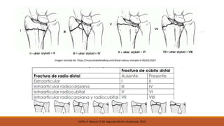 Clasificación Frykman y Fernández Fx Radio Distal | PPTX