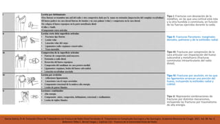 Clasificación Frykman y Fernández Fx Radio Distal | PPTX