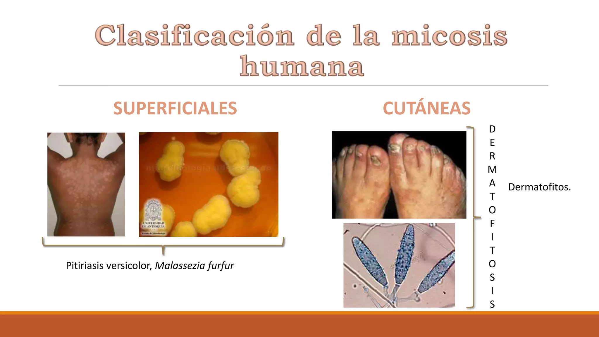 Clasificación general de los hongos | PPTX
