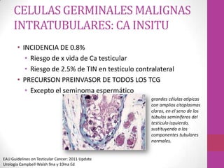 Clasificación histológica de tumores de células germinales | PPTX