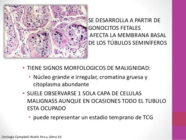Clasificación histológica de tumores de células germinales