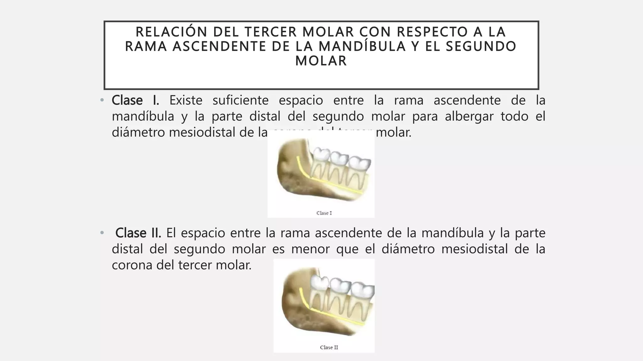Clasificación terceros molares.pptx