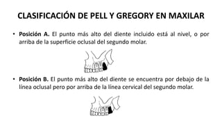 Clasificación terceros molares.pptx
