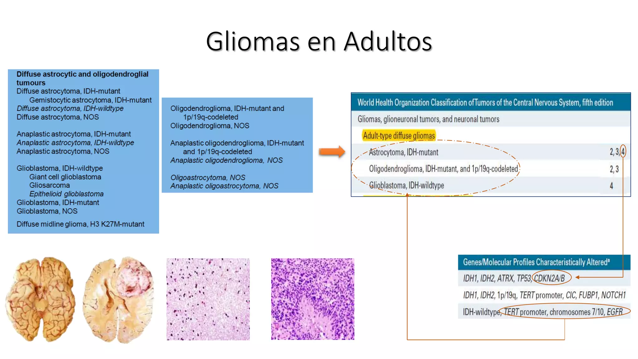 Clasificación Tumores SNC – OMS 2021.pptx