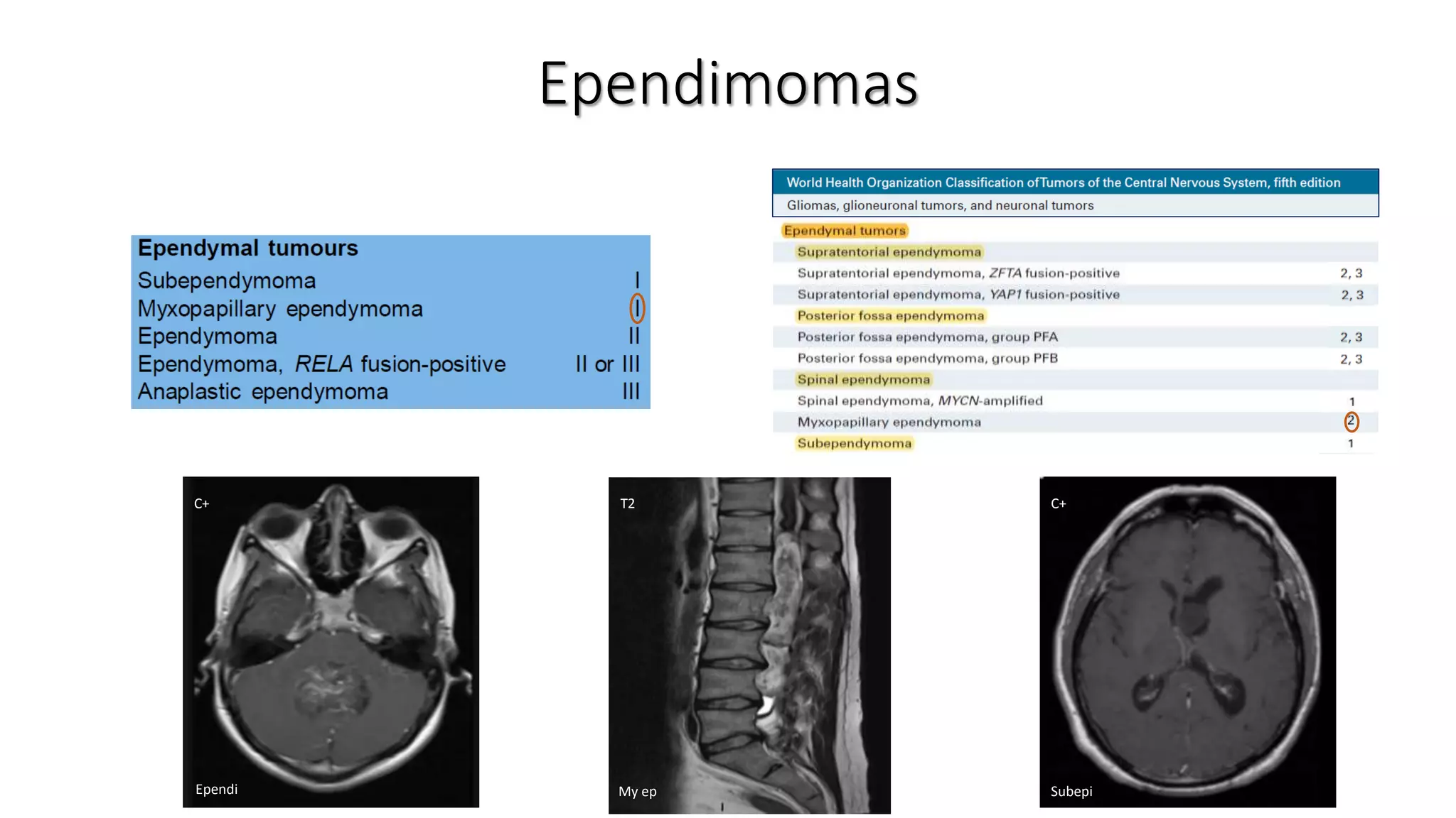 Clasificación Tumores SNC – OMS 2021.pptx