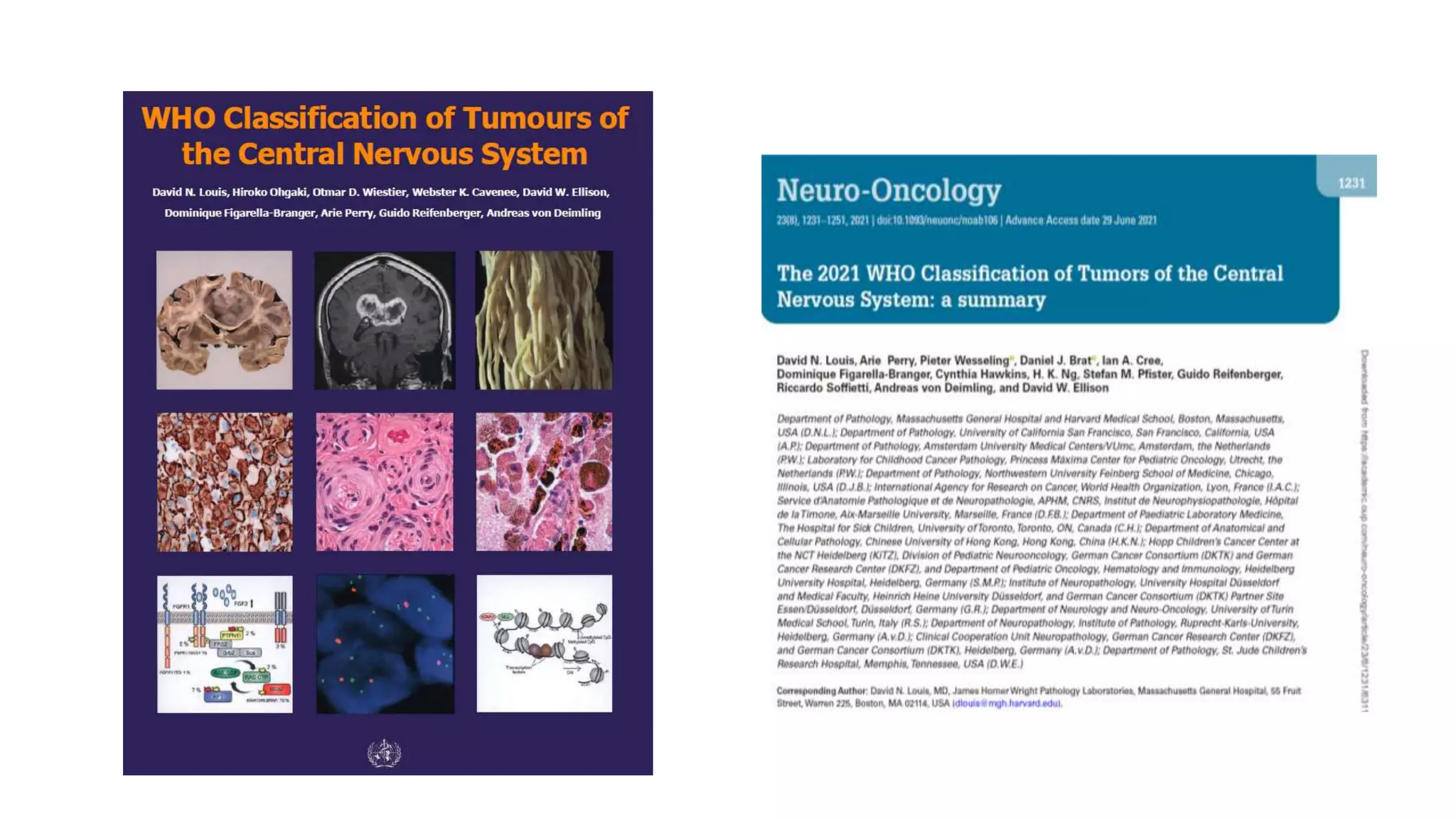 Clasificación Tumores SNC – OMS 2021.pptx