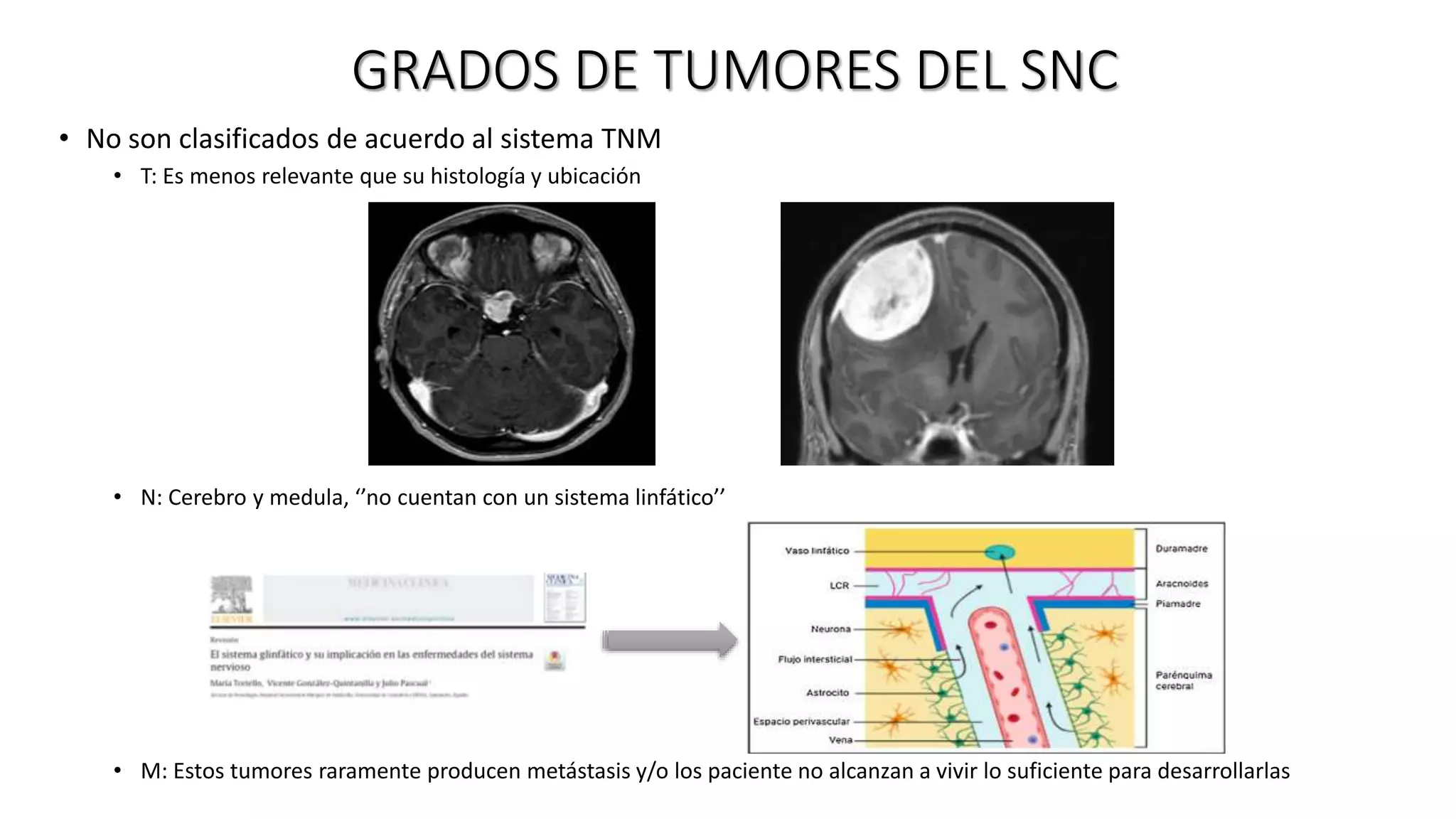 Clasificación Tumores SNC – OMS 2021.pptx