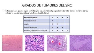 Clasificación Tumores SNC – OMS 2021.pptx