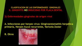 Clasificacion de las enfermedades gingivales y periodontale | PPTX