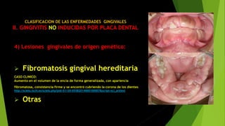 Clasificacion de las enfermedades gingivales y periodontale | PPTX