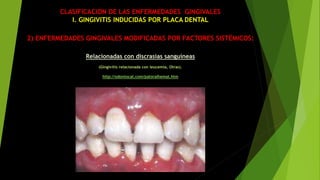 Clasificacion de las enfermedades gingivales y periodontale | PPTX