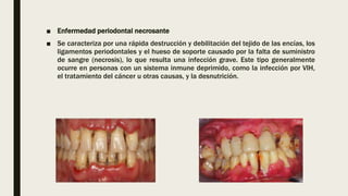 Una nueva clasificación para las enfermedades y condiciones ...