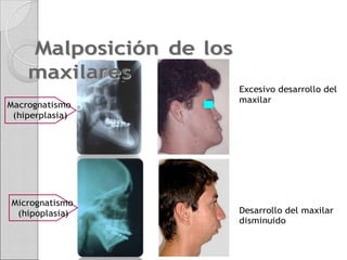 clasificacion-de-lisher.docx
