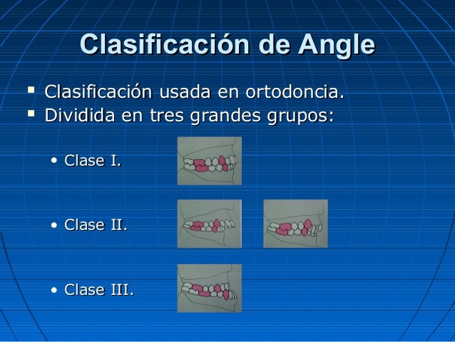 Clasificacion angle