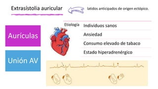CLASIFICACION ARRITMIAS .pptx