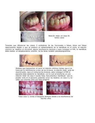 Clasificacion de angle | DOCX
