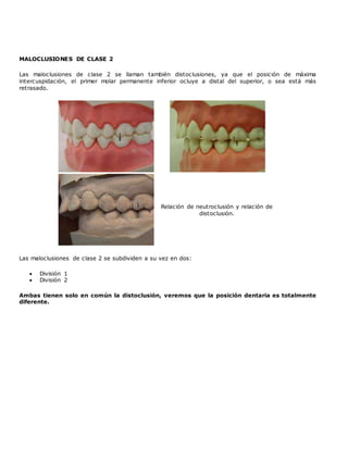 Clasificacion de angle | DOCX