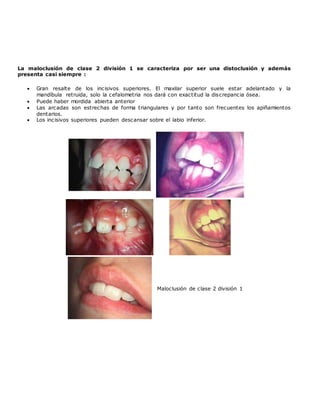 Clasificacion de angle | DOCX