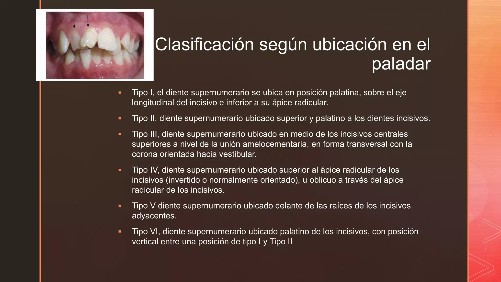 Clasificacion de dientes supernumerarios | PPTX