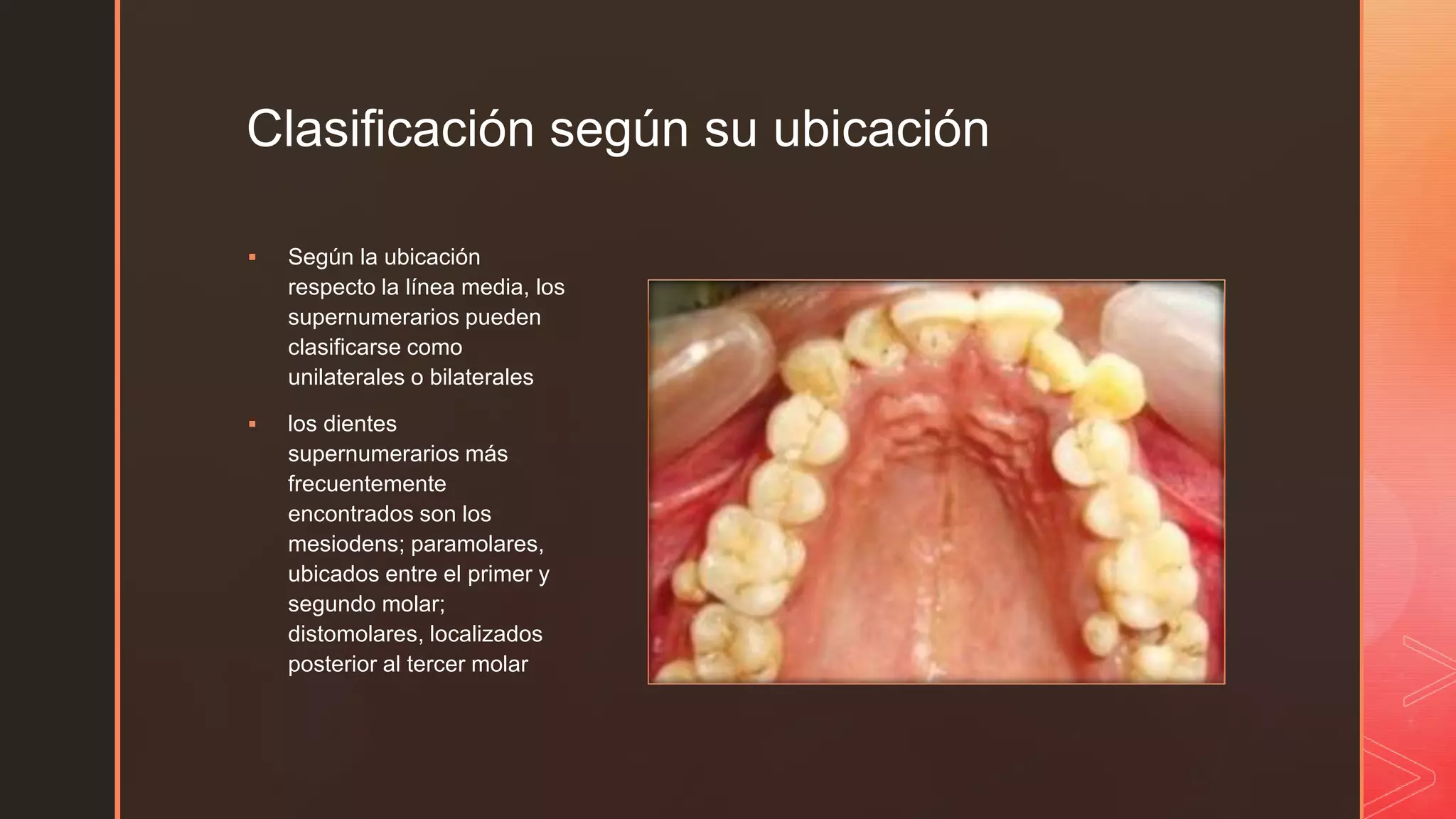 Clasificacion de dientes supernumerarios | PPTX
