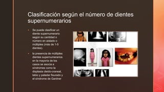 Clasificacion de dientes supernumerarios | PPTX