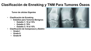 Clasificacion de Enniking y TNM para Tumores Oseos .pptx