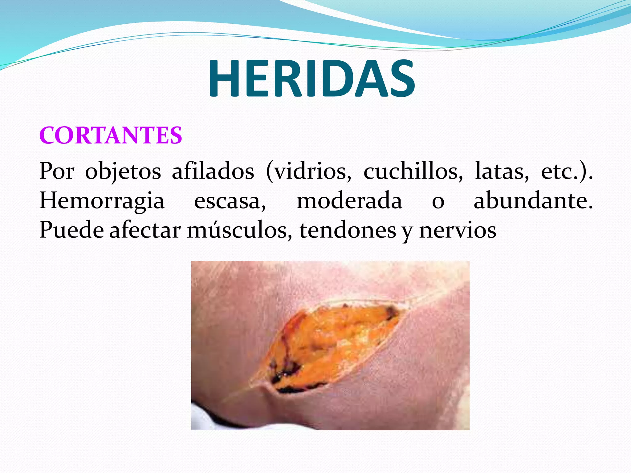 CLASIFICACIÓN DE HERIDAS%2c TIPOS%2c COMPLICACIONES 7 (1) - copia.pp…