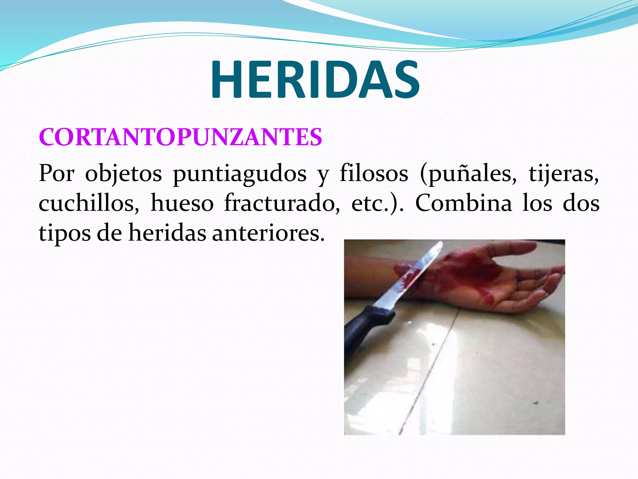 CLASIFICACIÓN DE HERIDAS%2c TIPOS%2c COMPLICACIONES 7 (1) - copia.pp…