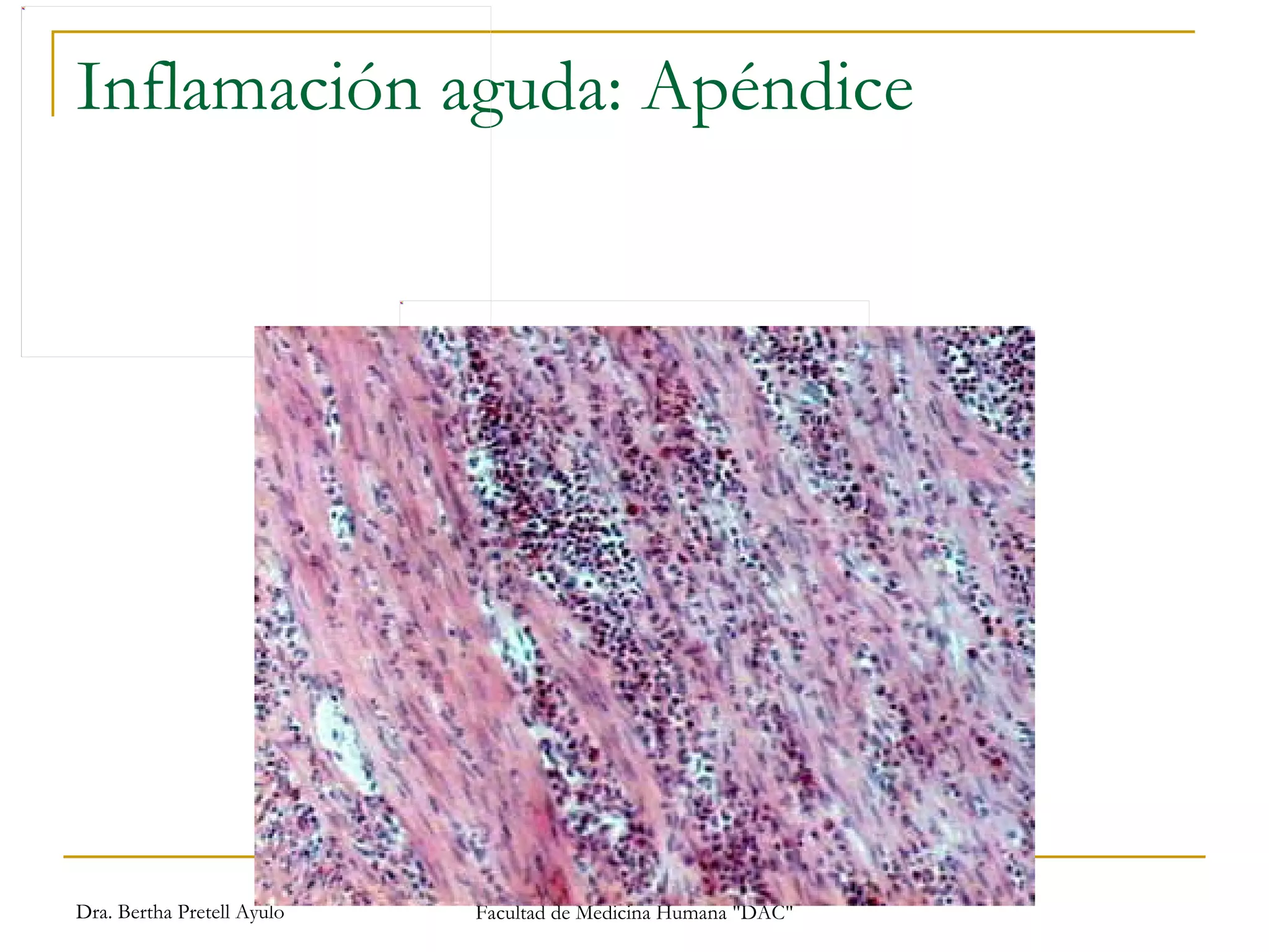 Clasificacion de la_inflamacion | PPT