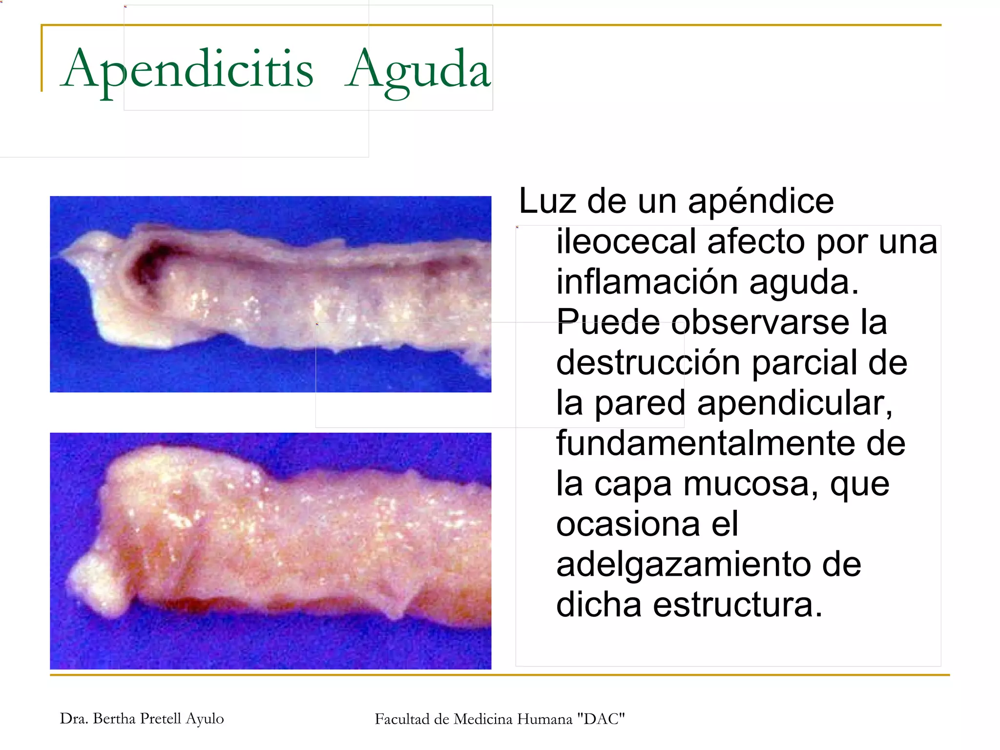 Clasificacion de la_inflamacion | PPT