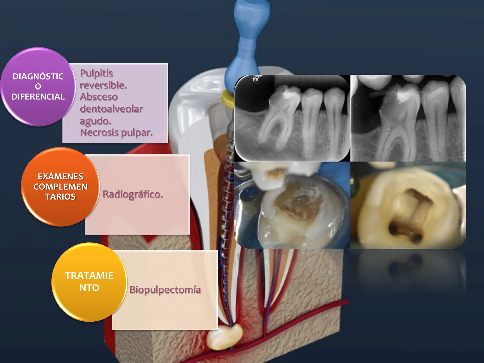 Clasificación de la patología pulpar y periapical según la AAE (1).pdf