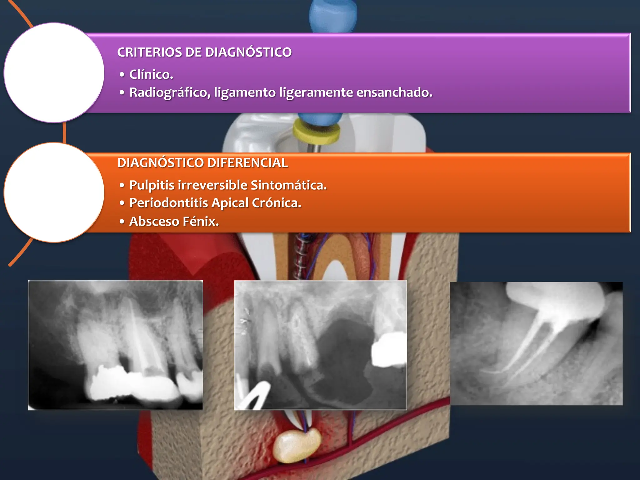 Clasificación de la patología pulpar y periapical según la AAE (1).pdf