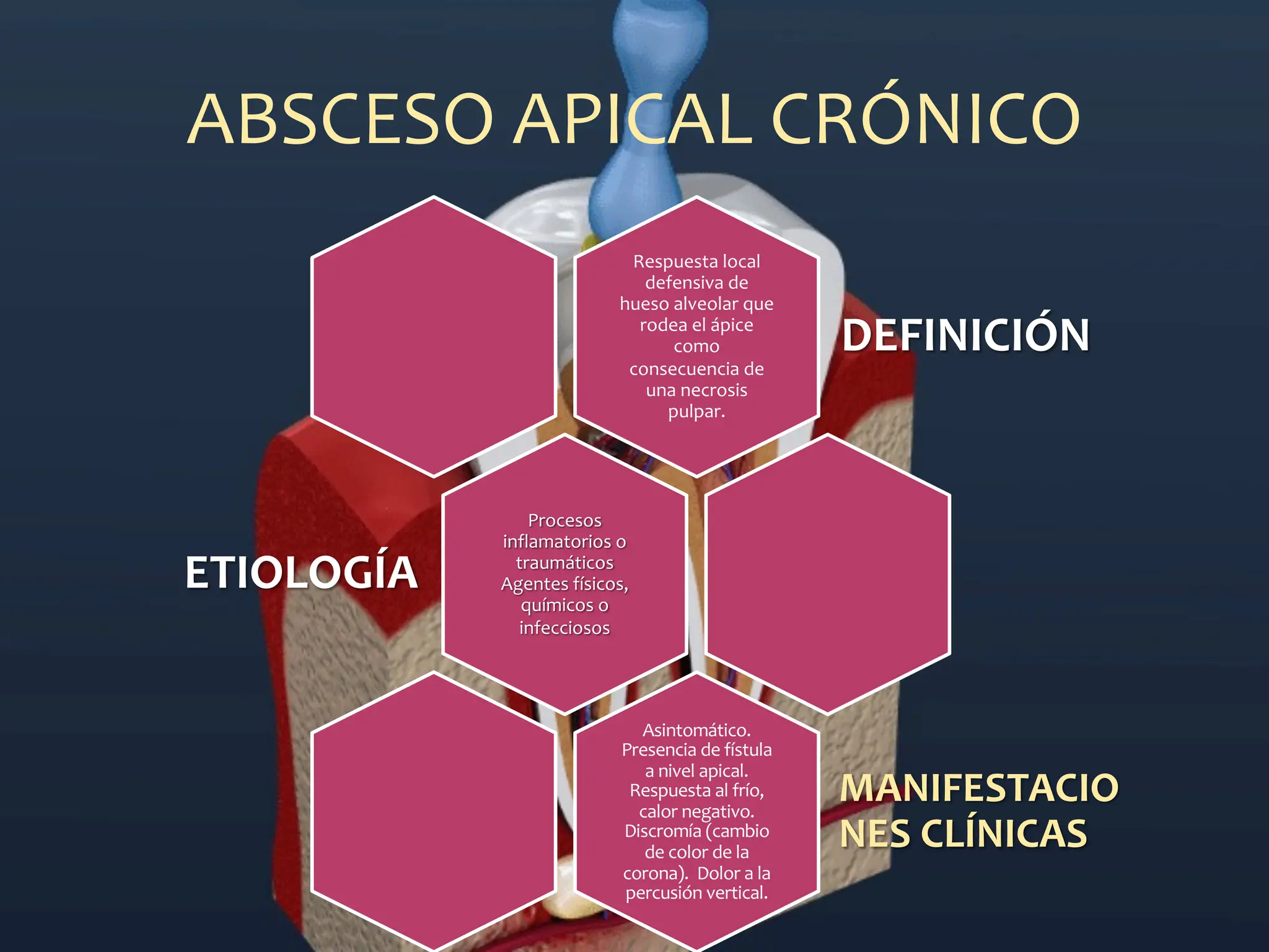 Clasificación de la patología pulpar y periapical según la AAE (1).pdf