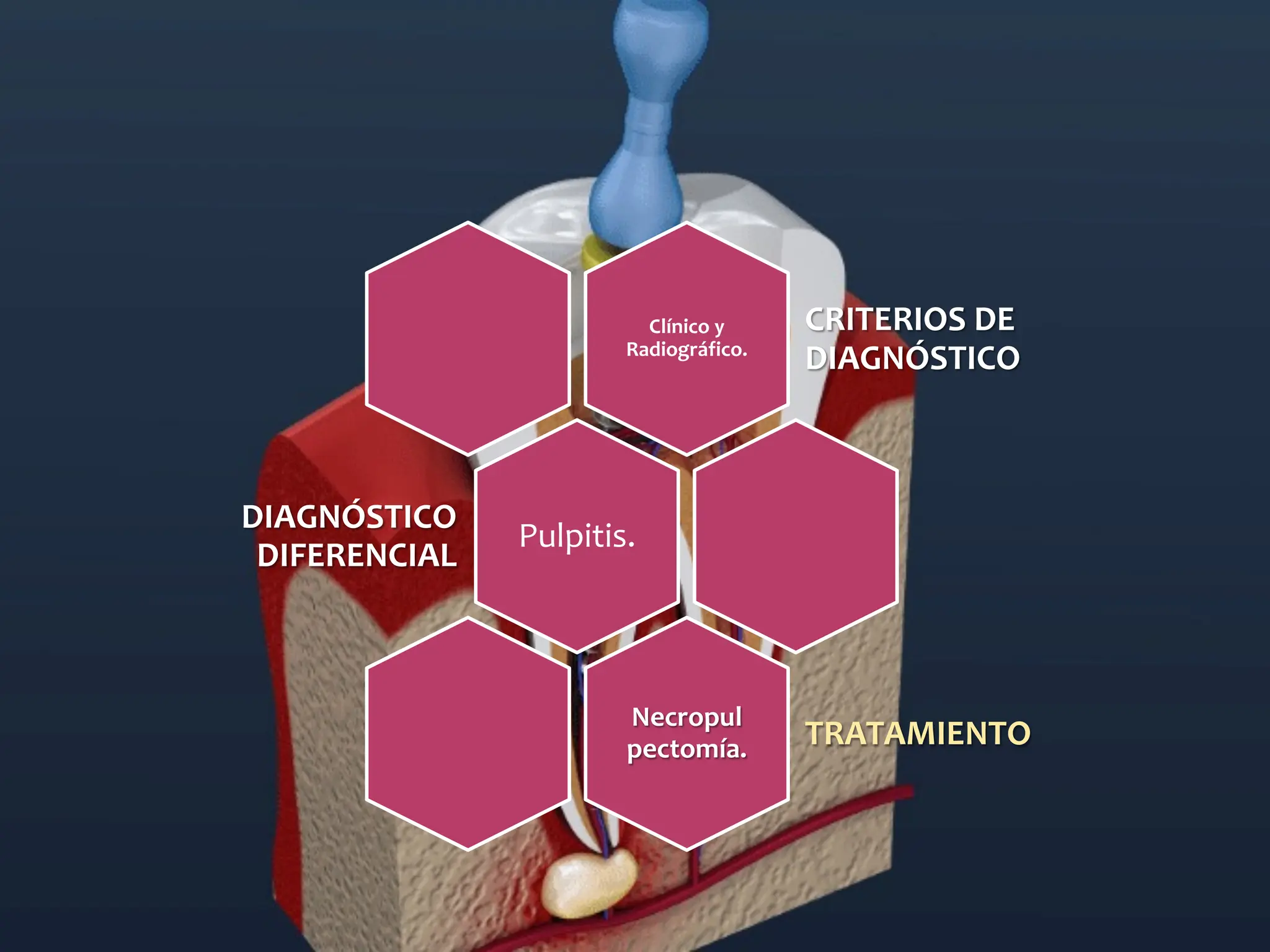 Clasificación de la patología pulpar y periapical según la AAE (1).pdf