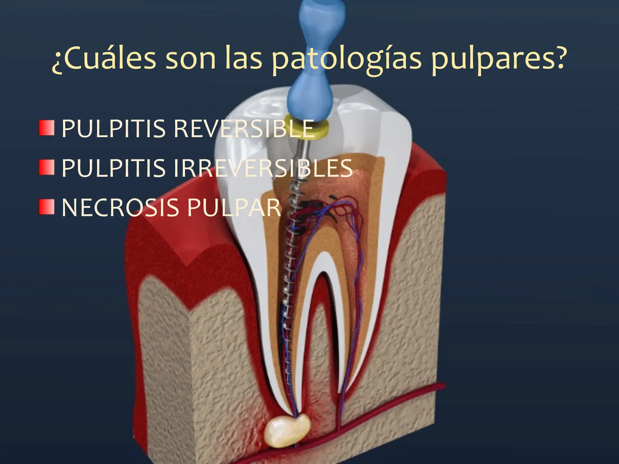 Clasificación de la patología pulpar y periapical según la AAE (1).pdf