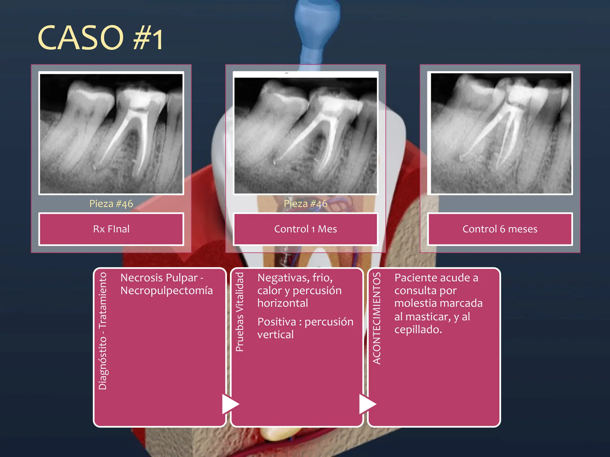 Clasificación de la patología pulpar y periapical según la AAE (1).pdf