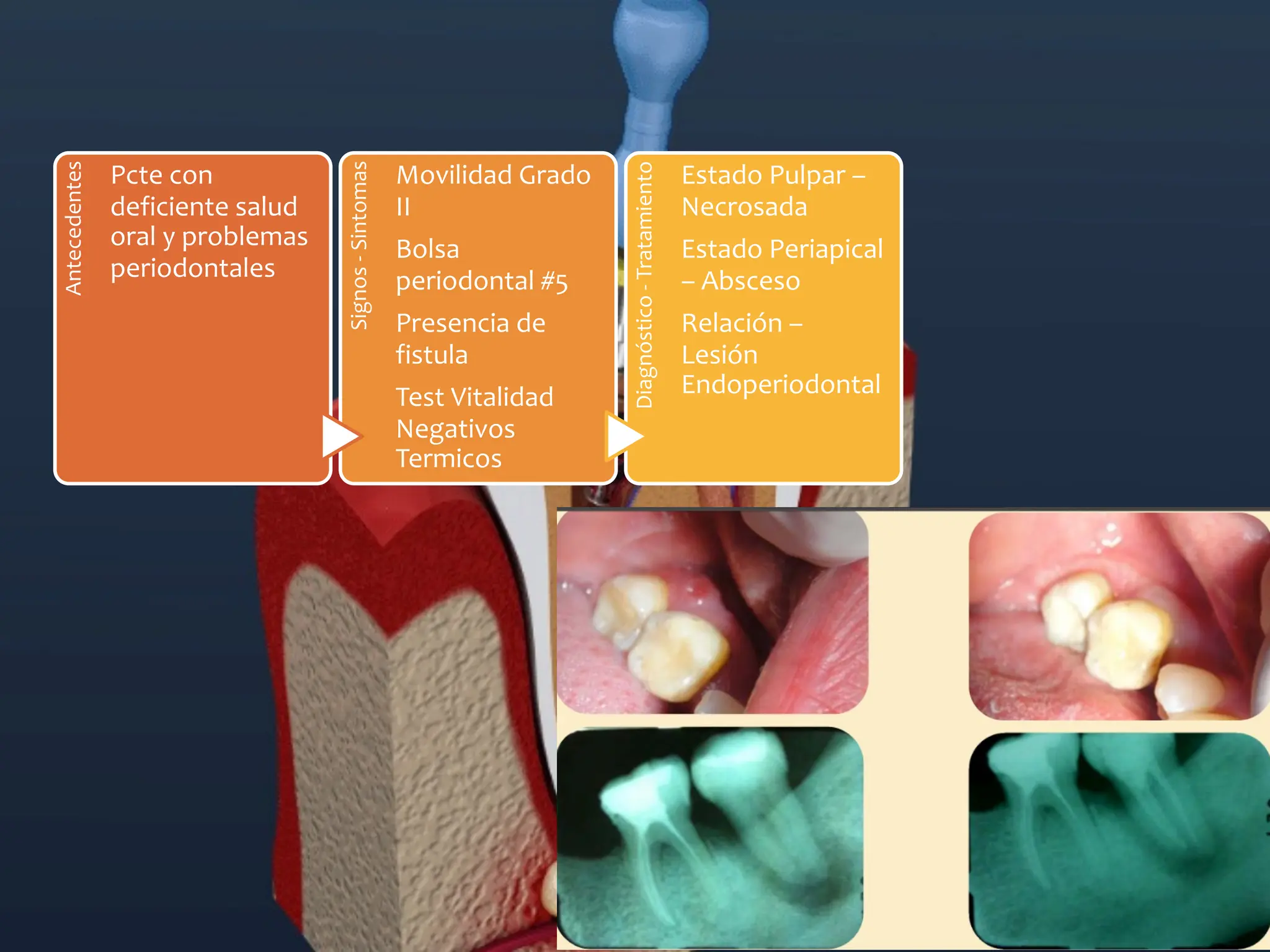 Clasificación de la patología pulpar y periapical según la AAE (1).pdf