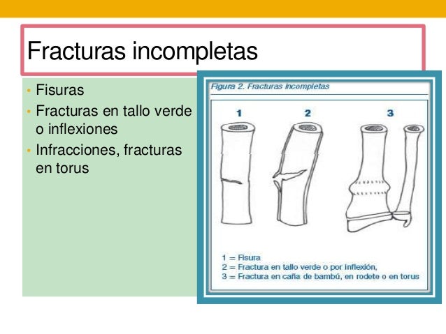 PRACTICA SUPERVISADA: INFORMACIÓN