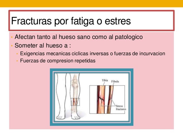 Clasificacion de las fracturas