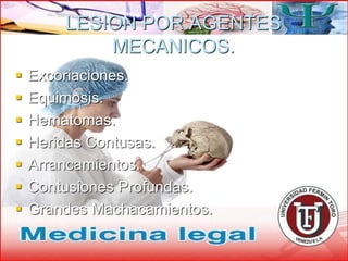 Clasificacion de lesiones y criterios | PDF