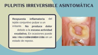 Clasificación e Interpretación de Lesiones Pulpares | PDF