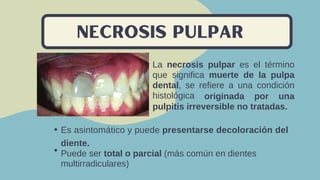 Clasificación e Interpretación de Lesiones Pulpares | PDF