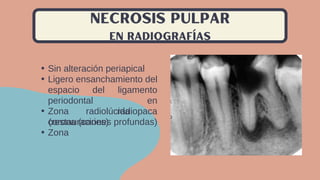 Clasificación e Interpretación de Lesiones Pulpares | PDF