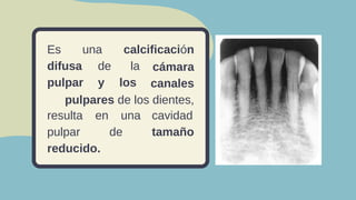 Clasificación e Interpretación de Lesiones Pulpares | PDF