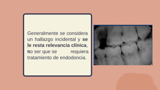 Clasificación e Interpretación de Lesiones Pulpares | PDF