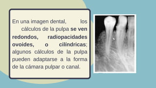 Clasificación e Interpretación de Lesiones Pulpares | PDF