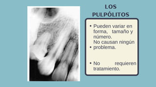 Clasificación e Interpretación de Lesiones Pulpares | PDF | Dental ...