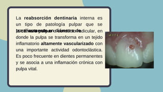 Clasificación e Interpretación de Lesiones Pulpares | PDF