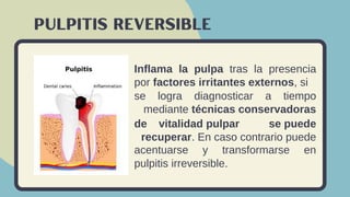 Clasificación e Interpretación de Lesiones Pulpares | PDF